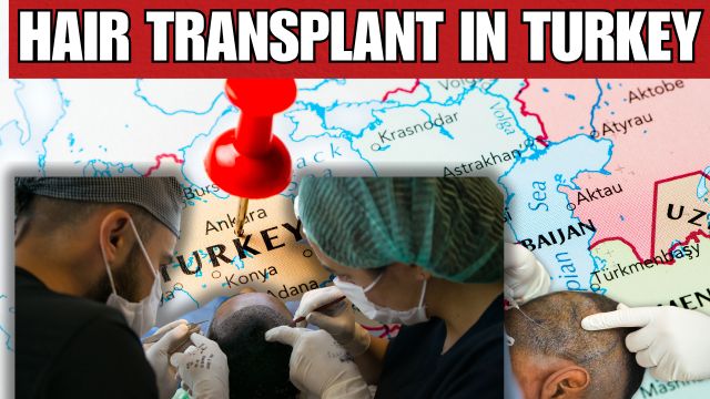 News: How Turkey Became The Hair Transplant Capitol of the World